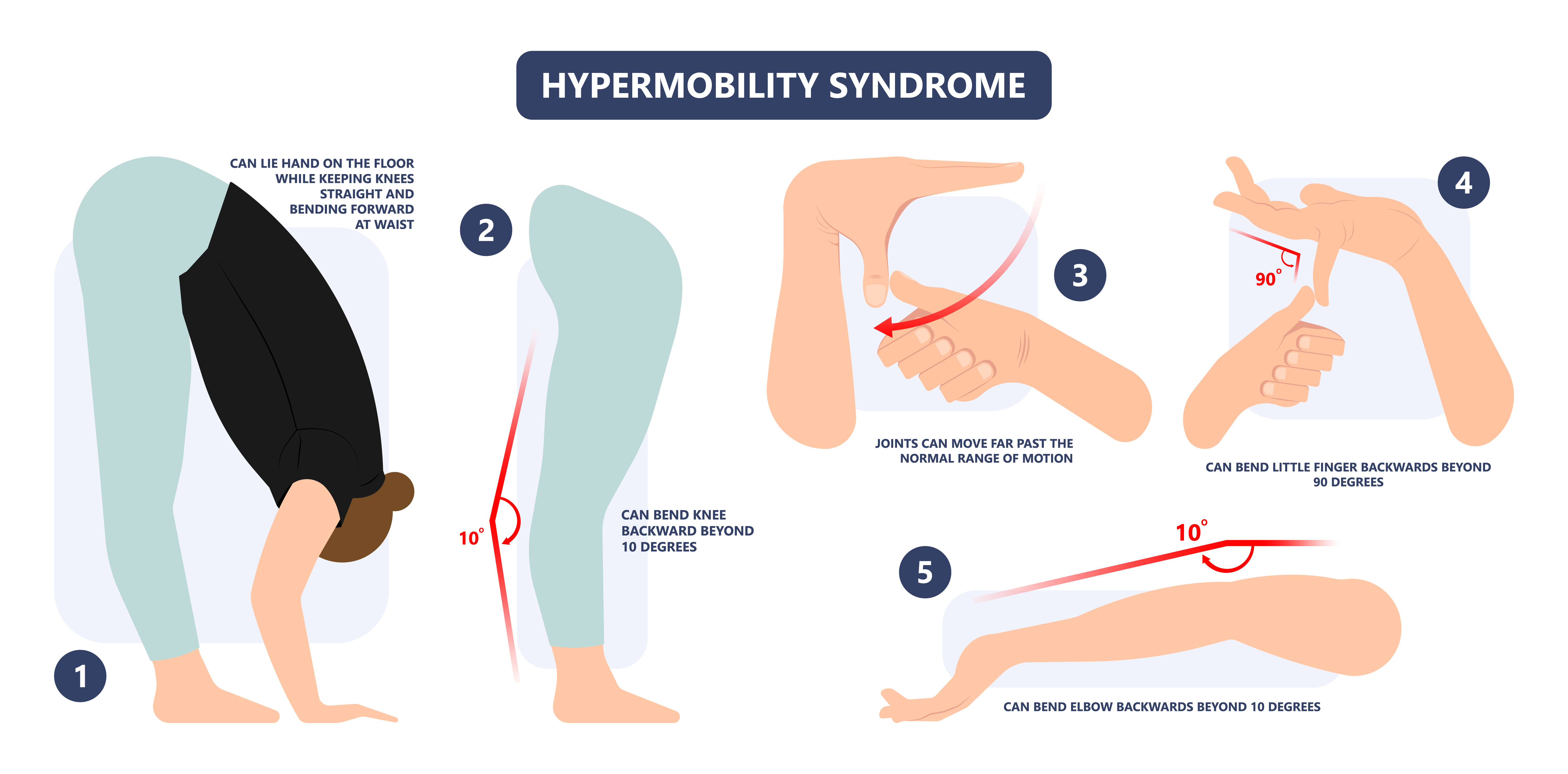 Hypermobility Workshops | Kinetic Edge Physical Therapy